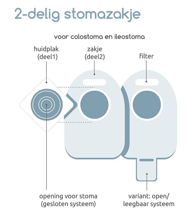 Materialen colostoma
