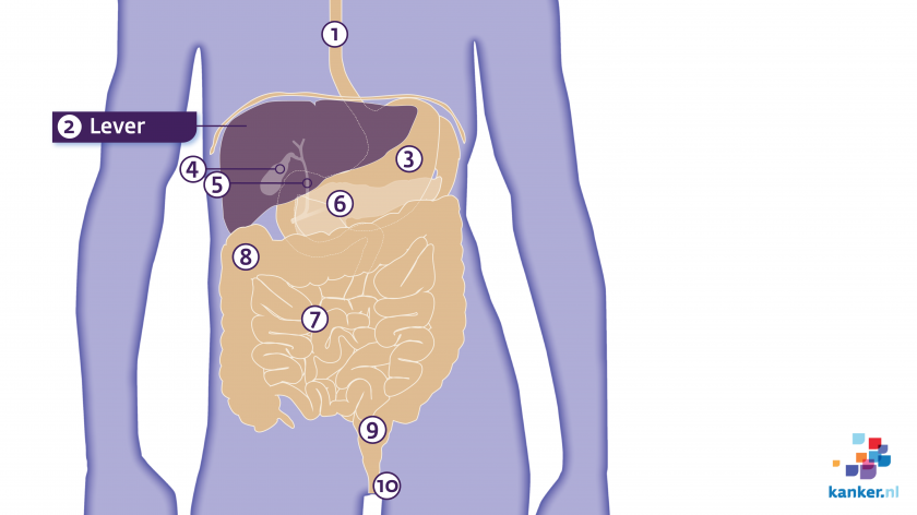Leverkanker / Hepatocellulair carcinoom