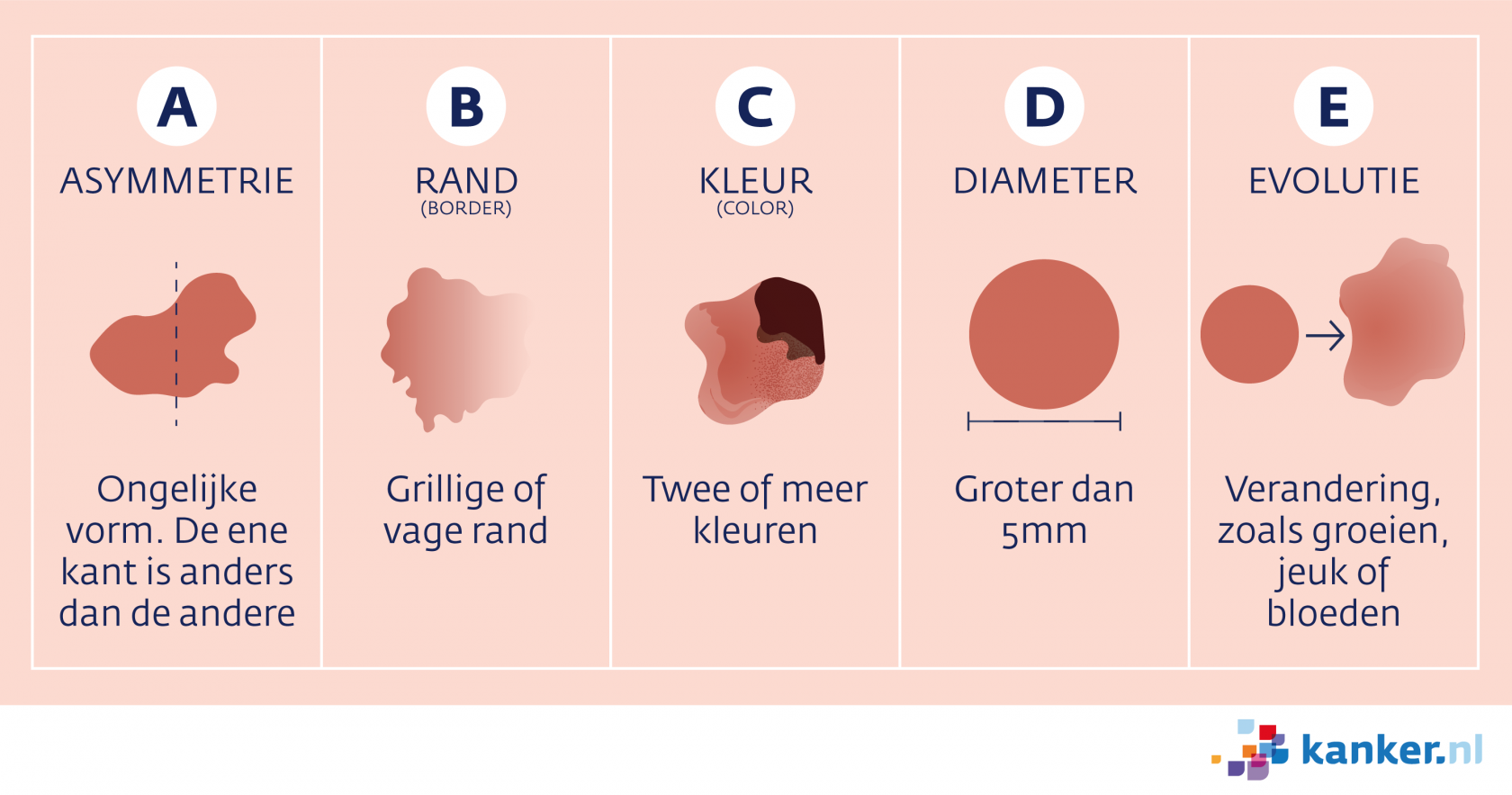 Herken een melanoom met de ABCDE-regel | Kanker.nl