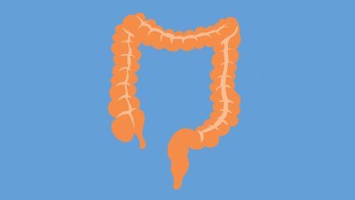 Darmkanker | Kanker.nl